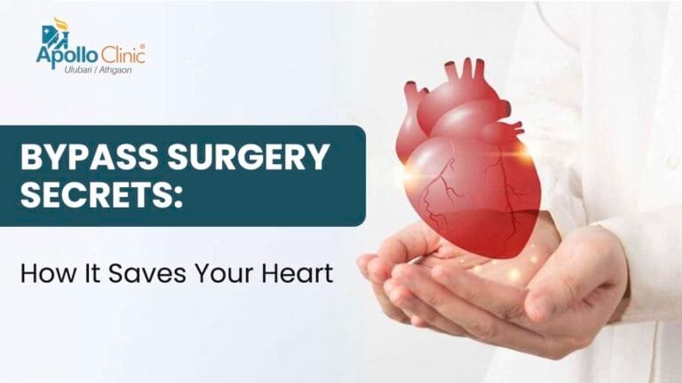 Bypass Surgery Secrets: How It Saves Your Heart